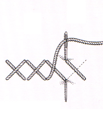 Numbness in forearm with stitches, trinity college cross stitch kit ...